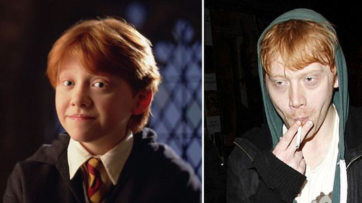 El triste antes y después de uno de los protagonistas de Harry Potter