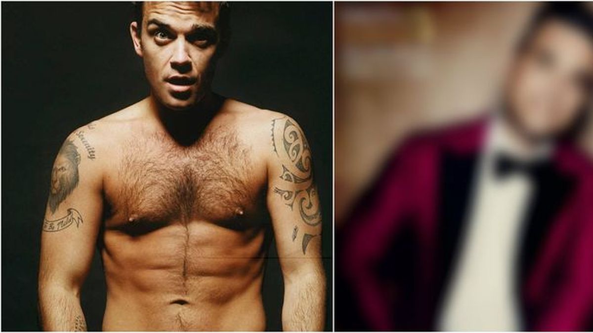 Robbie Williams se convirtió en otro cantante gracias a las cirugías ...