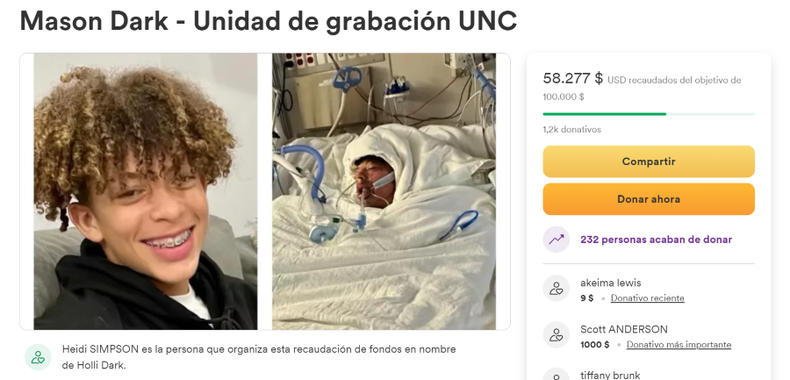 Estados Unidos: por un reto de TikTok, un adolescente se quemó el 80% ...