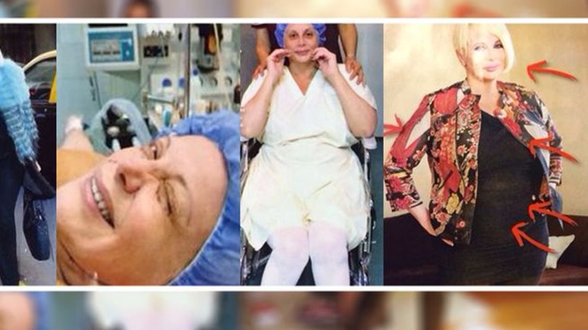 Carmen Barbieri recién operada; todo lo que se hizo: ya le dieron el alta