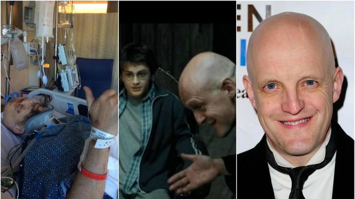 Jim Tavaré, actor de Harry Potter, en grave estado tras accidente de ...