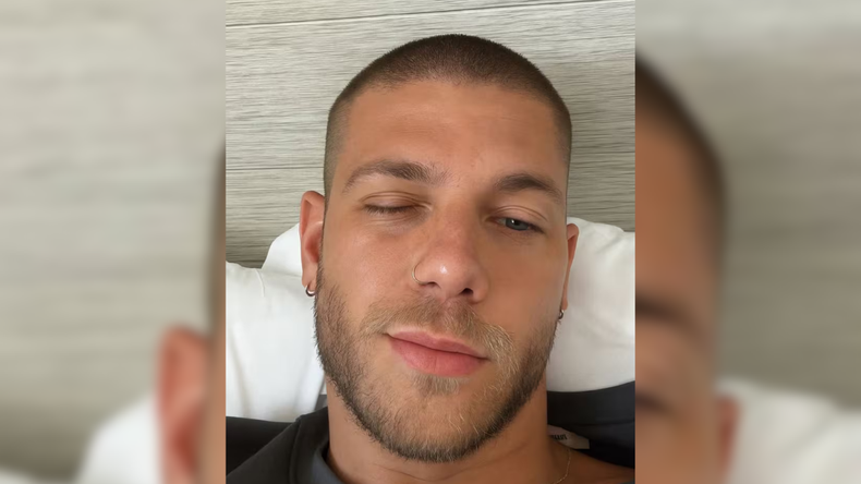 La impresionante transformación de Nacho Castañares que impactó a todos