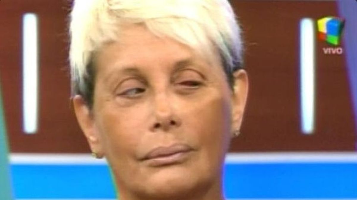 ¿Qué le pasó a Carmen Barbieri? Fue a la televisión con un ojo explotado