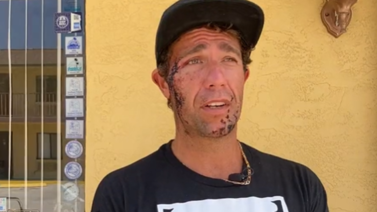 Estados Unidos: el inquitante testimonio de un surfista que sobrevivió ...