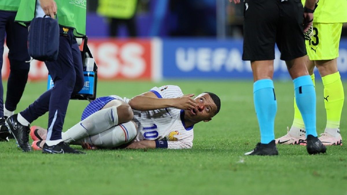 Alarma en Francia: Kylian Mbappé sufrió la fractura del tabique y se ...