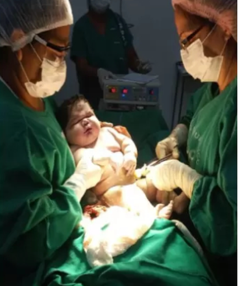 Nació y rompió un récord en Brasil: pesó 7.328 kilos y midió 59 centímetros